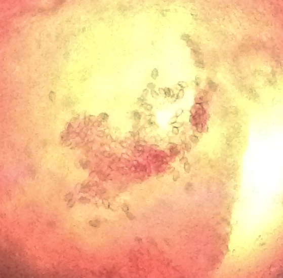 Pindsvinets snyltere – Pindsvineplejerne